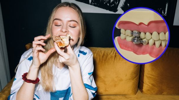¿Ridículo o innovador? Crean candado para dientes que ayuda a bajar de ...